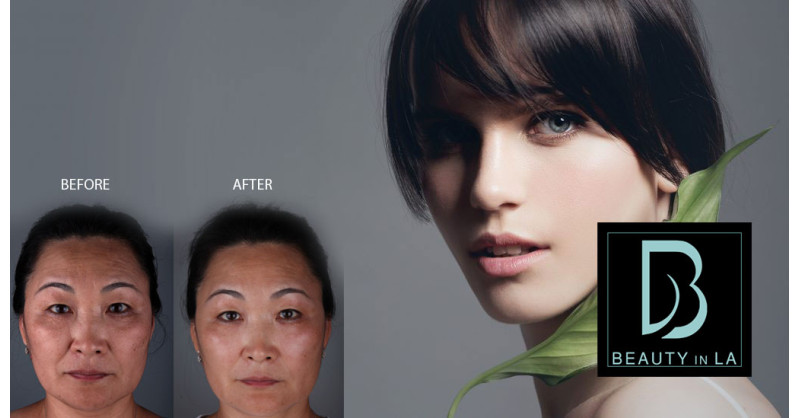 Discover Radiance at Beauty in LA Clinic: Where Excellence Meets Compassion